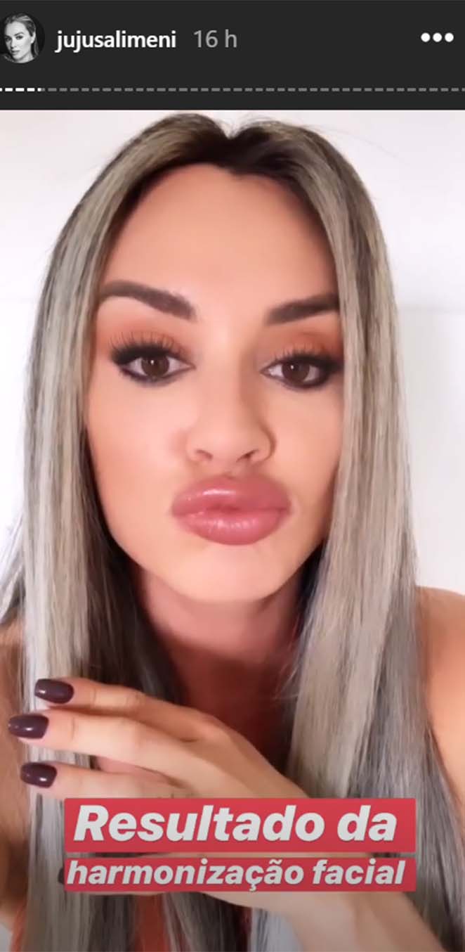 Juju Salimeni faz harmonização facial. Veja como ficou! - OFuxico