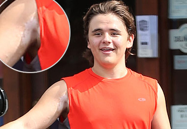 Prince Jackson Vitiligo