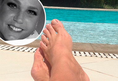 Com os pés pra cima, Xuxa comemora o sexto dia sem a bota ortopédica ...