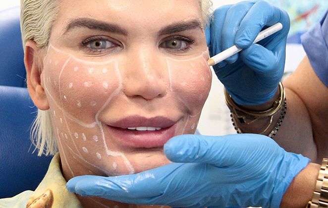 Ken Humano passa por mais um procedimento estético - OFuxico