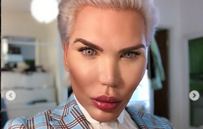 Rodrigo Alves, o Ken Humano, faz mais um procedimento estético - OFuxico
