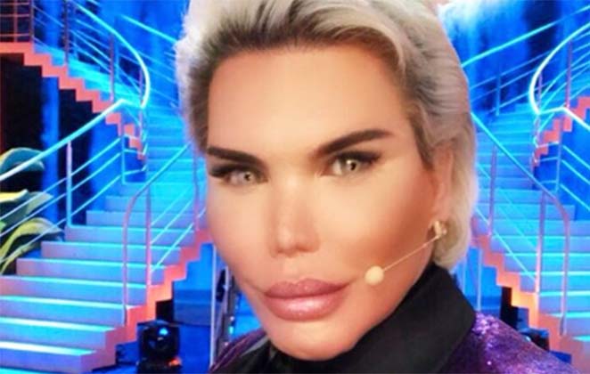 Ken Humano faz implante capilar de R$ 14 mil - OFuxico