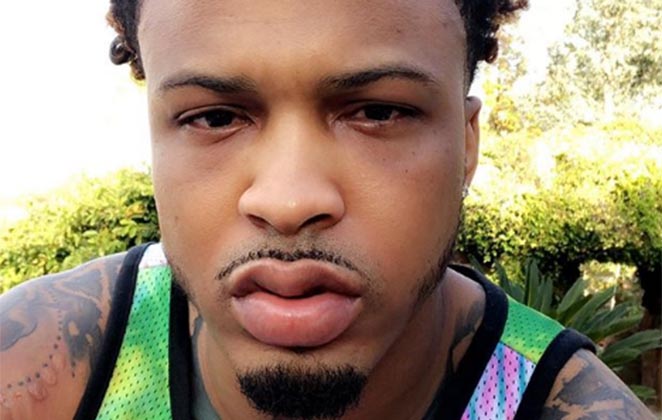 Rapper August Alsina revela que perdeu capacidade de andar - OFuxico