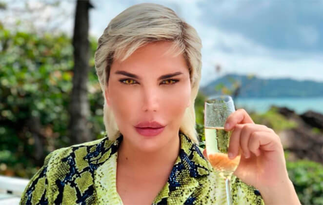 Ken Humano gastou mais de R$ 3 milhões com cirurgias - OFuxico