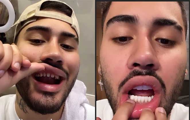 Não vale rir! Kevinho mostra dentes sem lentes e vira meme - OFuxico