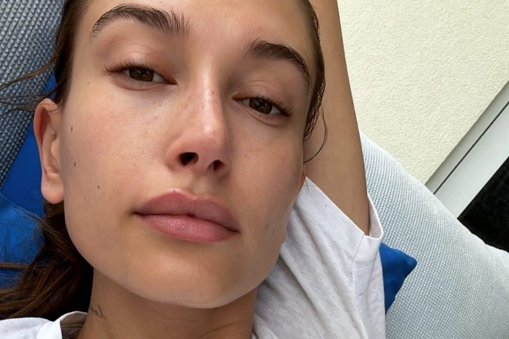 Hailey Bieber posa sem maquiagem e esbanja beleza natural