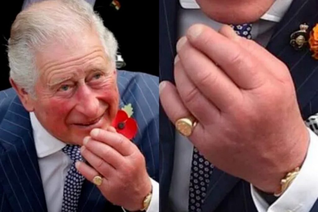Por que Charles III está com 'dedos de salsicha'? Entenda!