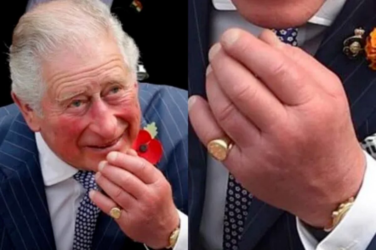 Por que Charles III está com 'dedos de salsicha'? Entenda!