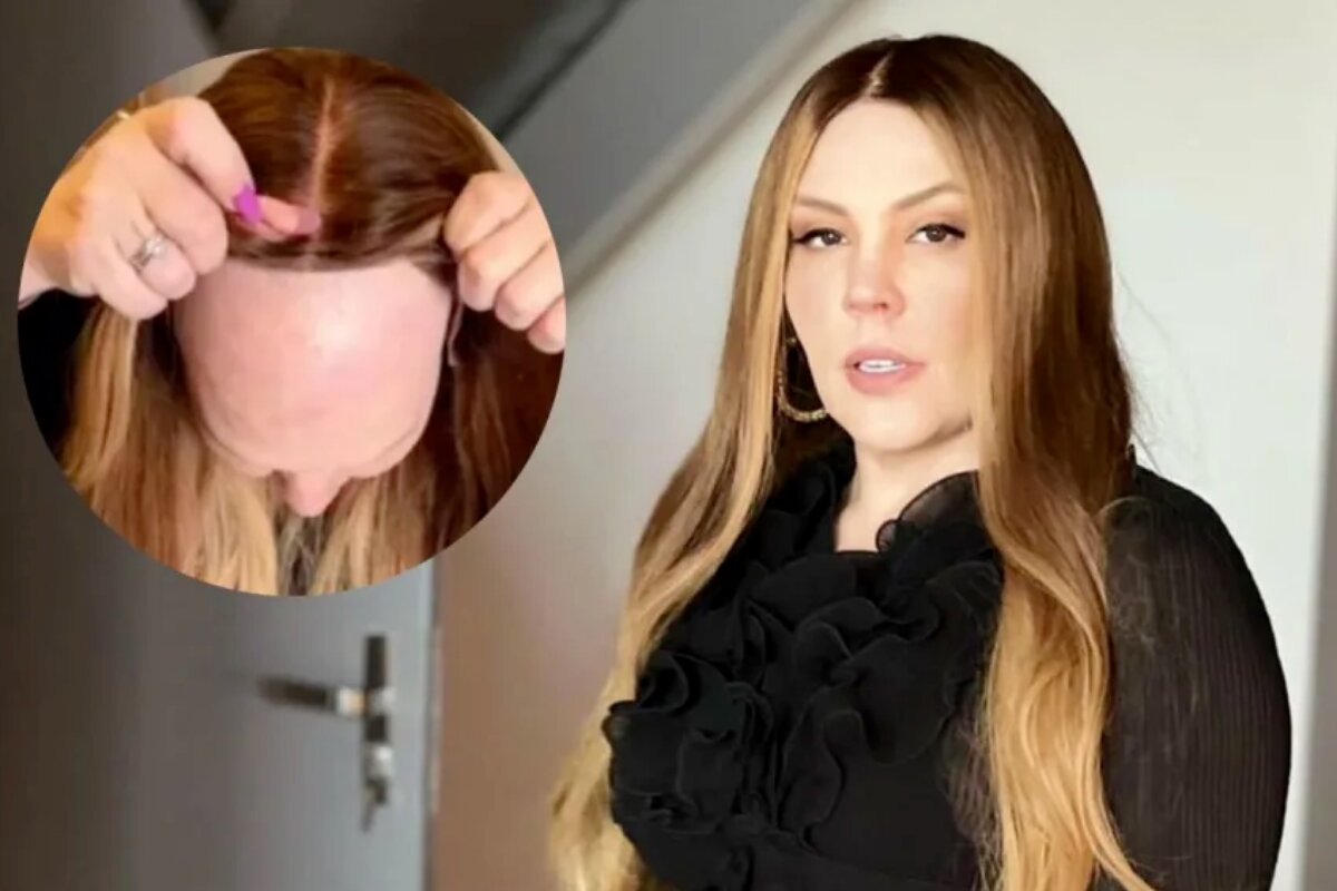 Simony mostra a cabeça raspada pela primeira vez