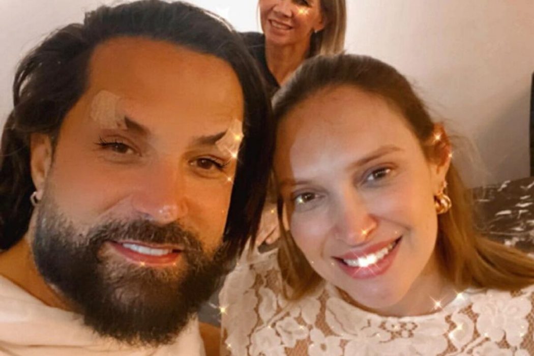 Latino passa por rejuvenescimento facial e resultado divide opiniões