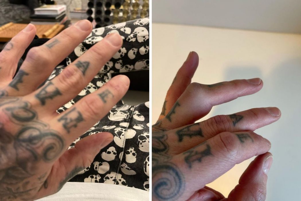 Travis Barker, do Blink-182, passará por procedimento no dedo - OFuxico