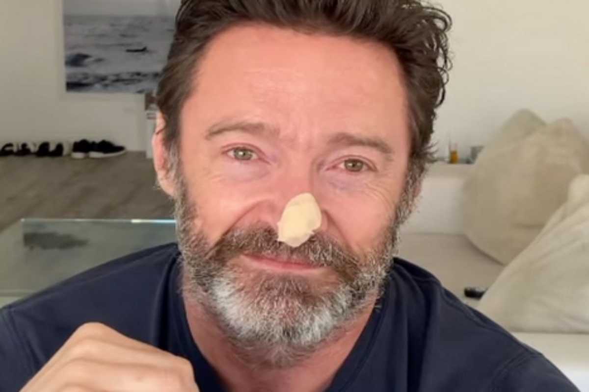 Hugh Jackman revela resultado das biópsias de câncer de pele