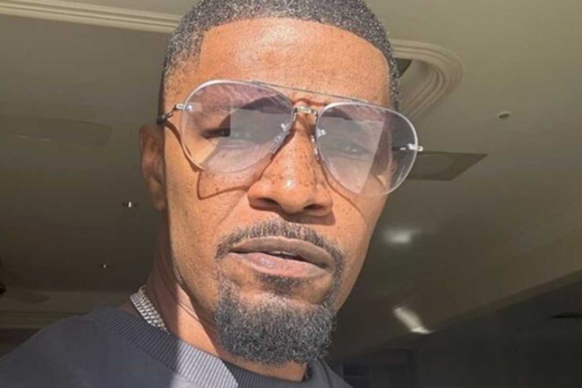 Jamie Foxx Hair Transplant